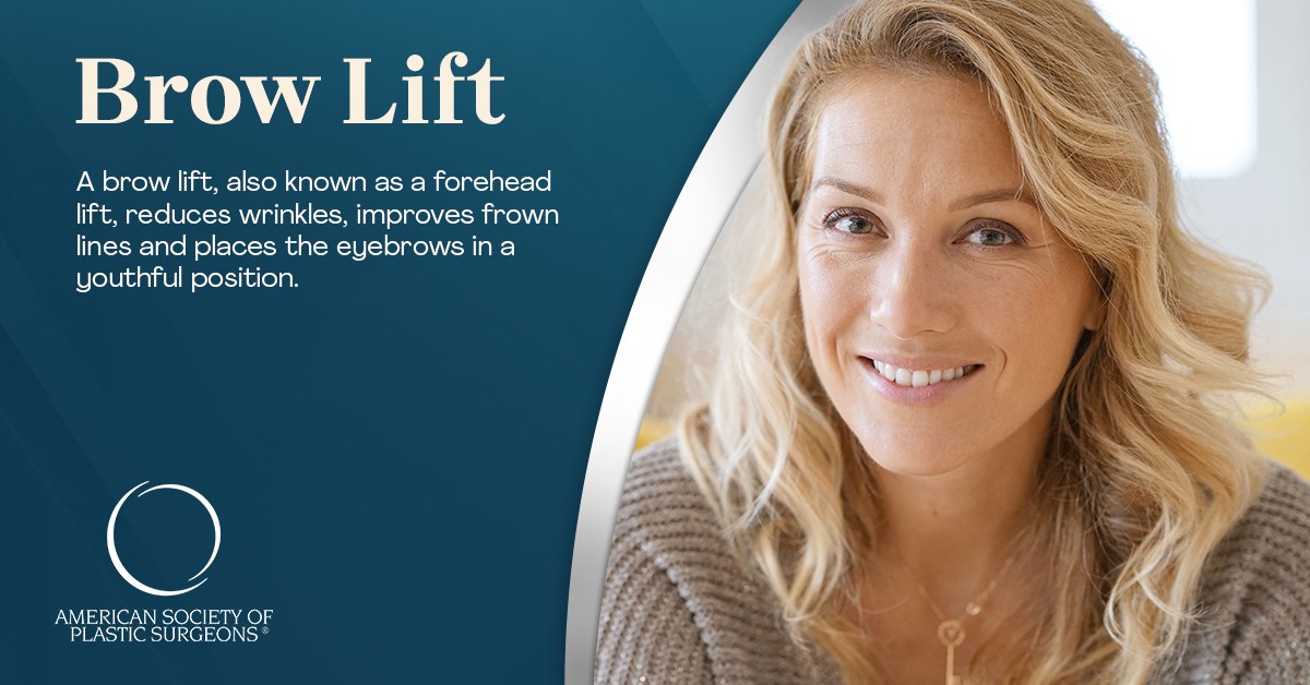 Brow Lift Recovery | American Society of Plastic Surgeons